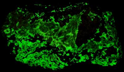 FOMS - Willemite - Franklin Mineral Information